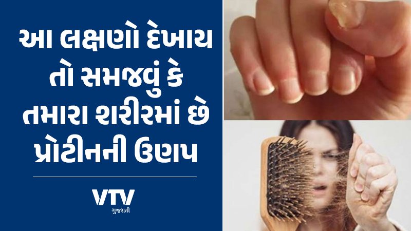 સાવધાન! જો-જો ક્યાંક તમારા શરીરમાં તો નથી ને પ્રોટીનની ઉણપ, શરીરમાં ...