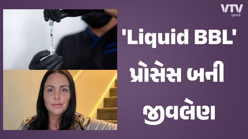નિતંબ વધારવાના ચક્કરમાં મહિલાનું મોત, 'Liquid BBL' પ્રોસેસ બની જીવલેણ ...