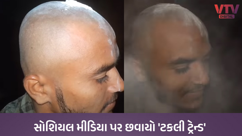 Takli Trend VIDEO: 9 કરોડ લોકોએ આ વીડિયો જોયો, હળદર પછી 'ટકલી ટ્રેન્ડ'એ ...